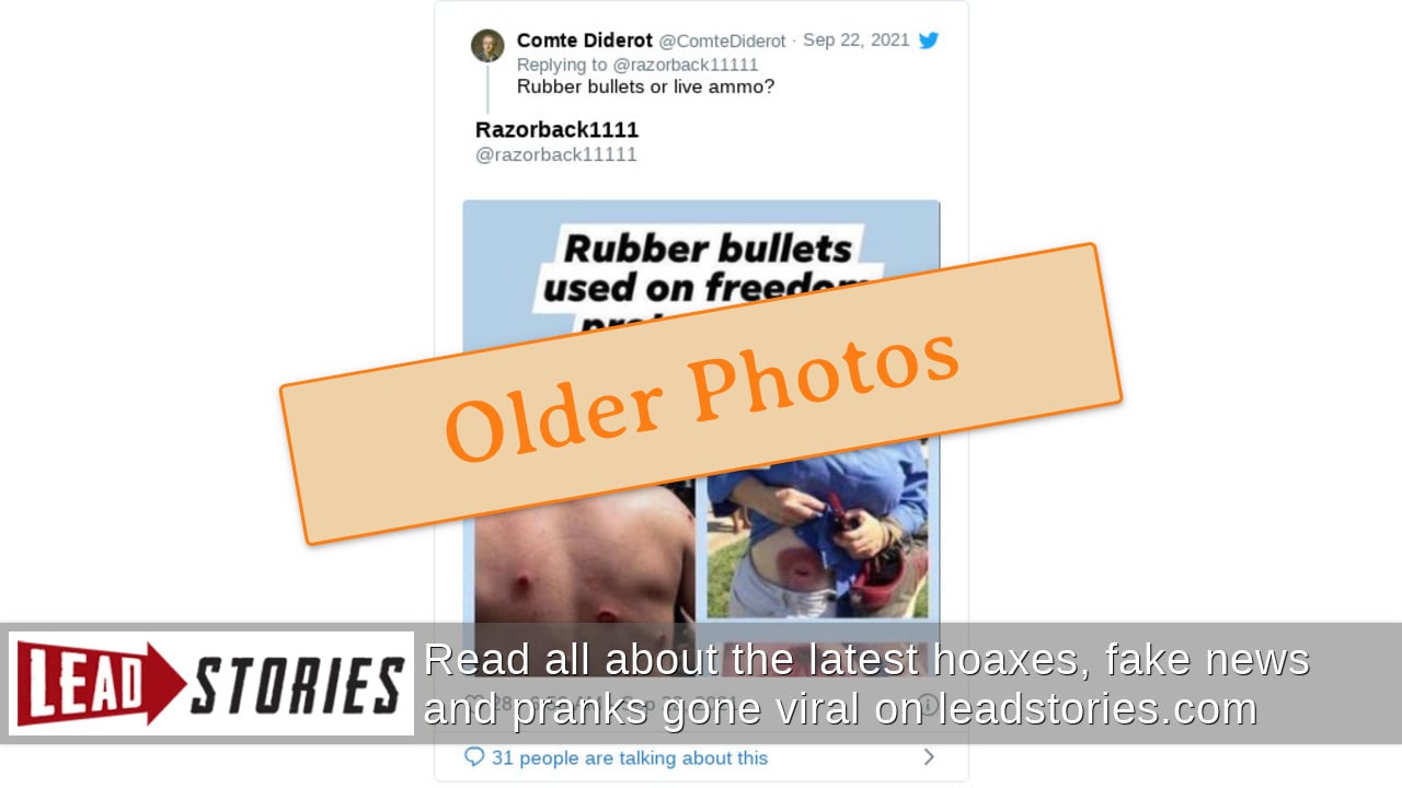 Fact Check: Photos Of People Wounded By Rubber Bullets Are NOT From ...