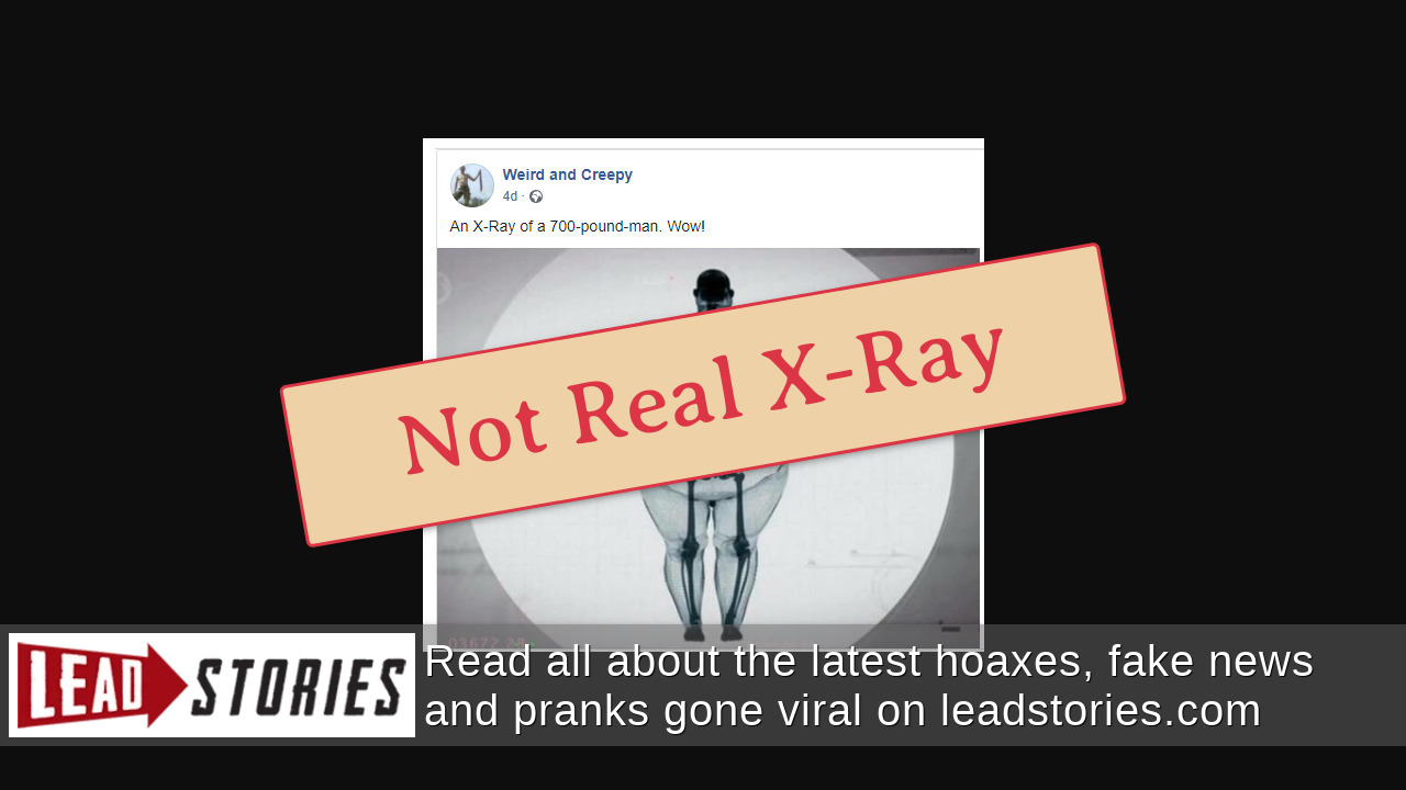 Fact Check: This Is NOT An X-Ray Of A 700-Pound Man -- It's A Digital ...